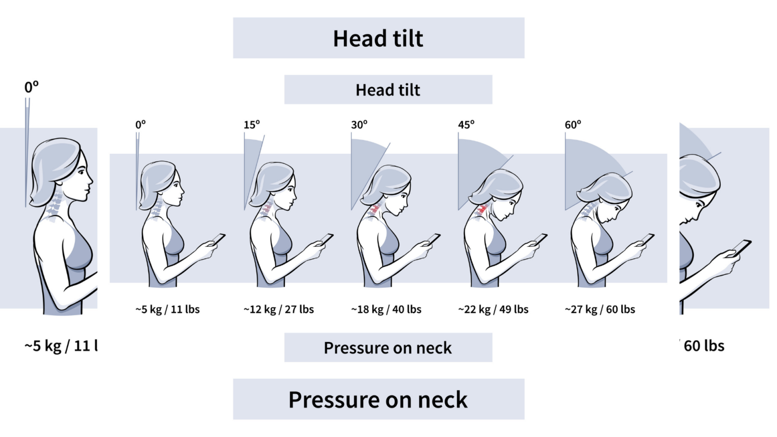 Text Neck Syndrome is Now a New Global Epidemic - YogaUOnline